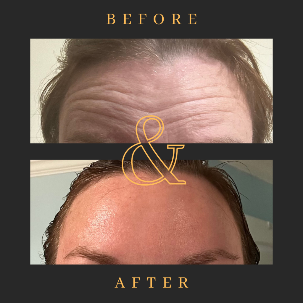 Before & After - Higher Self Aesthetics